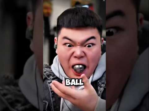 This man swallowed metal balls, but...