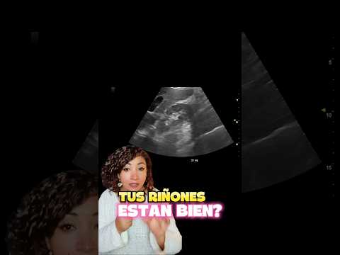 para que sirve un ultrasonido renal? #nefrologia
