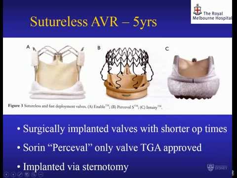 Mr Peter Skillington: Choice & timing of surgical procedures on the aorta & aortic valve