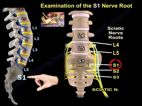 Examination Of S1 Nerve Root - Everything You Need To Know - Dr. Nabil Ebraheim