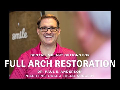 Full Arch Dental Implant Options