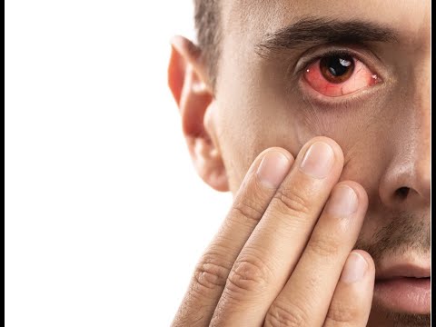 VA Disability Ratings for Eye Conditions.