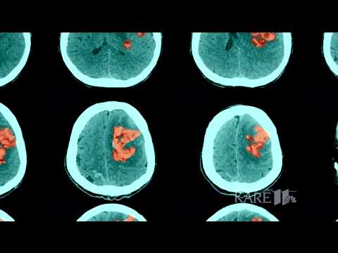 BTN11: Inside the revealing CTE study