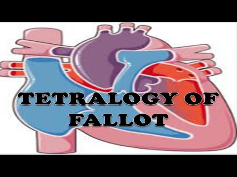 TETRALOGY OF FALLOT (TOF) DEFINITION, COMPONENTS, ETIOLOGY, HEMODYNAMICS, SYMPTOMS, TREATMENT