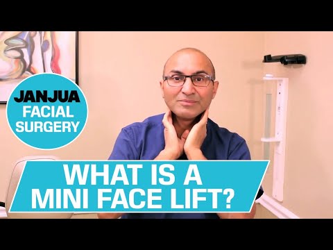 WHAT IS A MINI FACELIFT? - 59 PLUS 1 - DR. TANVEER JANJUA