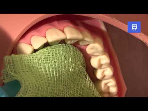 Management of an avulsed permanent tooth