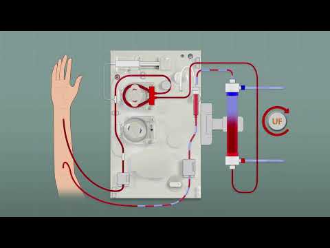 Let’s learn (Surdial X Training Series) - How does the Dialysate Infusion Function (DIF) work?
