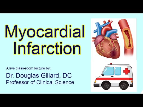 Heart Attack: Let's Learn All about Heart Attacks, Which Don't Always Occur from atherosclerosis!