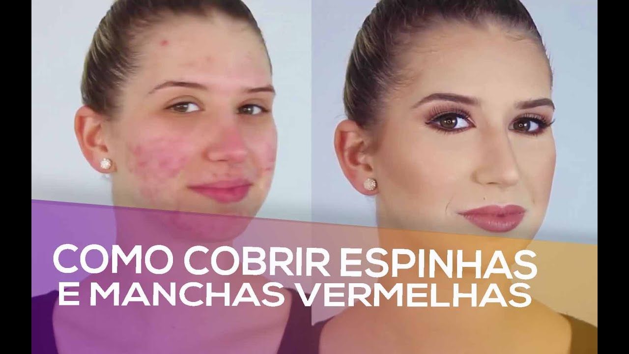 Como esconder espinhas com maquiagem!