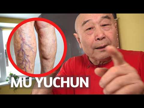 Attention! Large veins on the legs! Mu Yuchun.