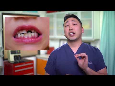 Quick Differences Between Primary and Permanent Teeth