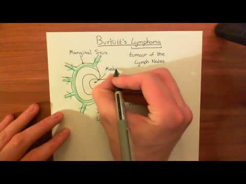Burkitt's Lymphoma Part 1