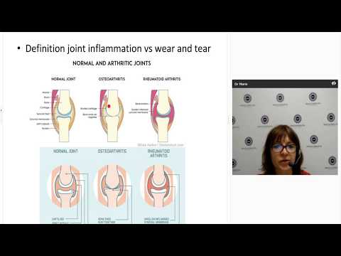 Diagnosing and managing psoriatic arthritis
