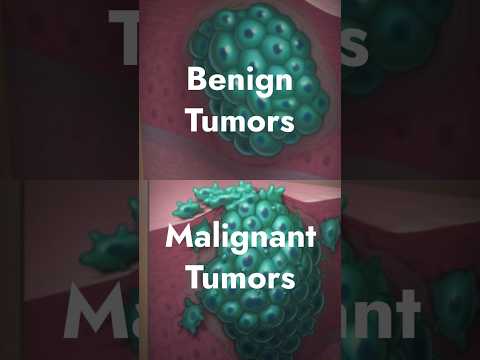 How Cancer spreads into the body | Benign Tumor vs Malignant Tumor #cancer #cancertypes