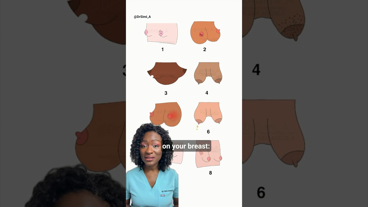 Don't Ignore These 8 Signs On Your Breast