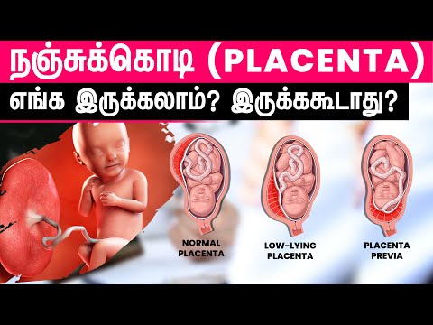 Placental Positions | நஞ்சுக்கொடி | Nanju kodi | Dr. Priya Kalyani