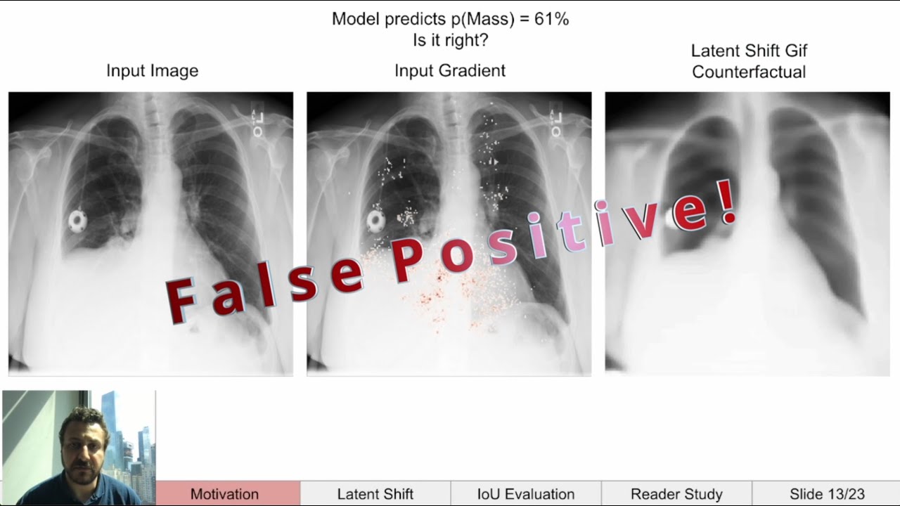 Gifsplanation via Latent Shift Talk - MIDL2021