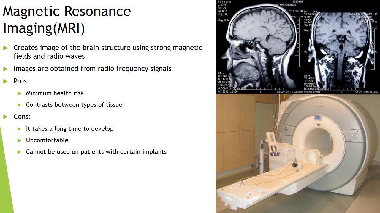 Neuroimaging big data Analytics using Cloud computing