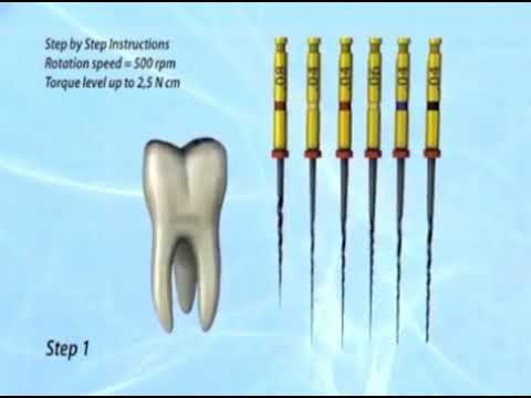 Healix NiTi Rotary Files | pinkblue
