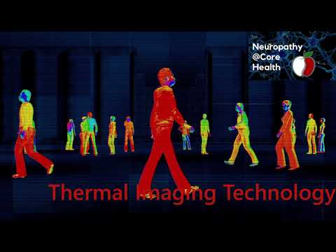 Thermal Imaging Scan Neuropathy@CoreHealth