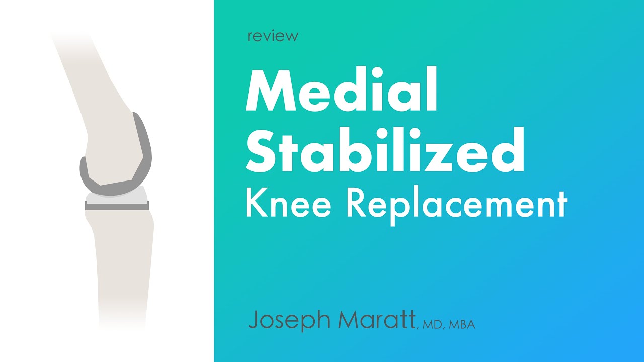 Medial Stabilized Knee Replacement