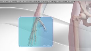 Patient Education in Orthopedic Surgery – OrthoPedia Patient