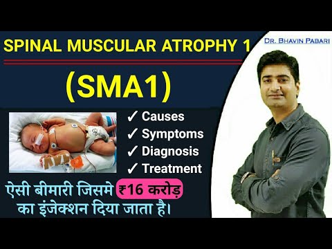 ₹16 CR Injection in Spinal Muscular Atrophy 1 | SMA1 | CAUSES | SYMPTOMS | DIAGNOSIS | TREATMENT |