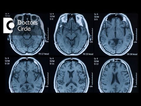 4 Tests to detect Parkinson's Disease - Dr. Guruprasad Hosurkar