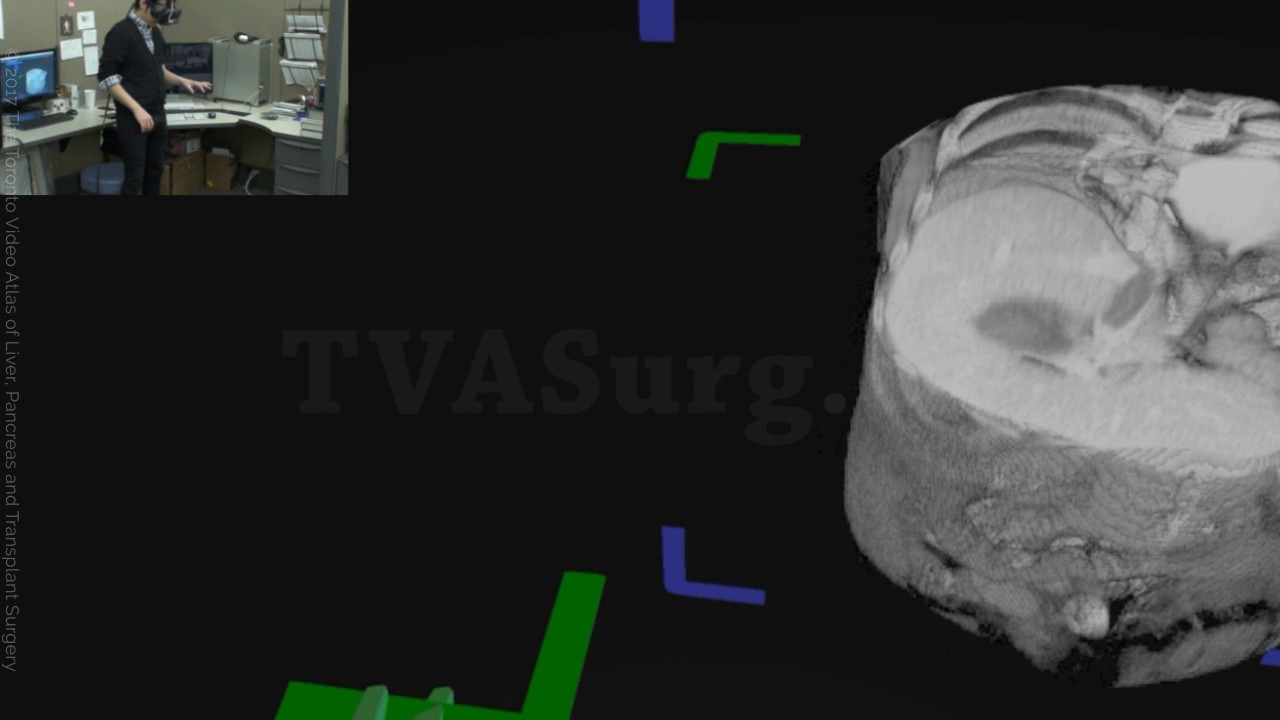 TVASurg Medical Imaging VR Module