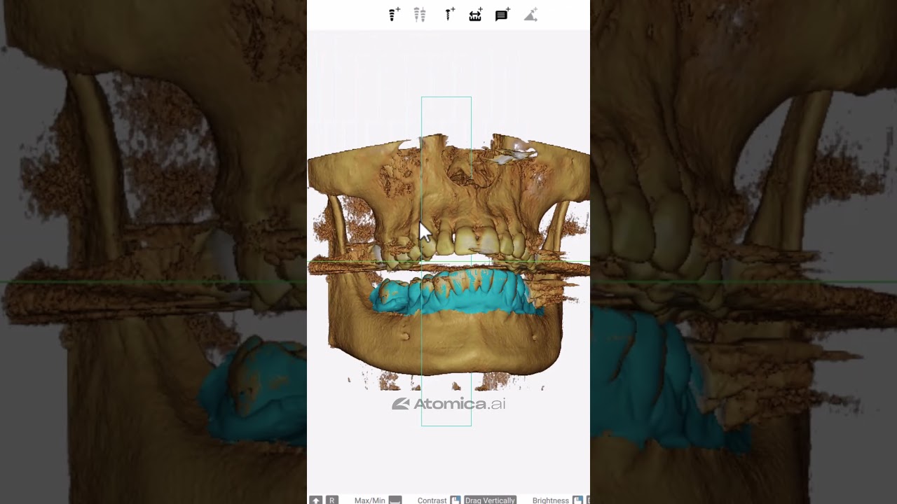 🚀 Fast and Automatic Model Registration!🔍