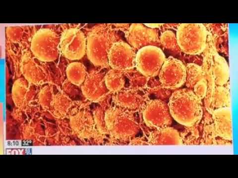 Brown vs. white fat - Do you know the difference? 2-8-16
