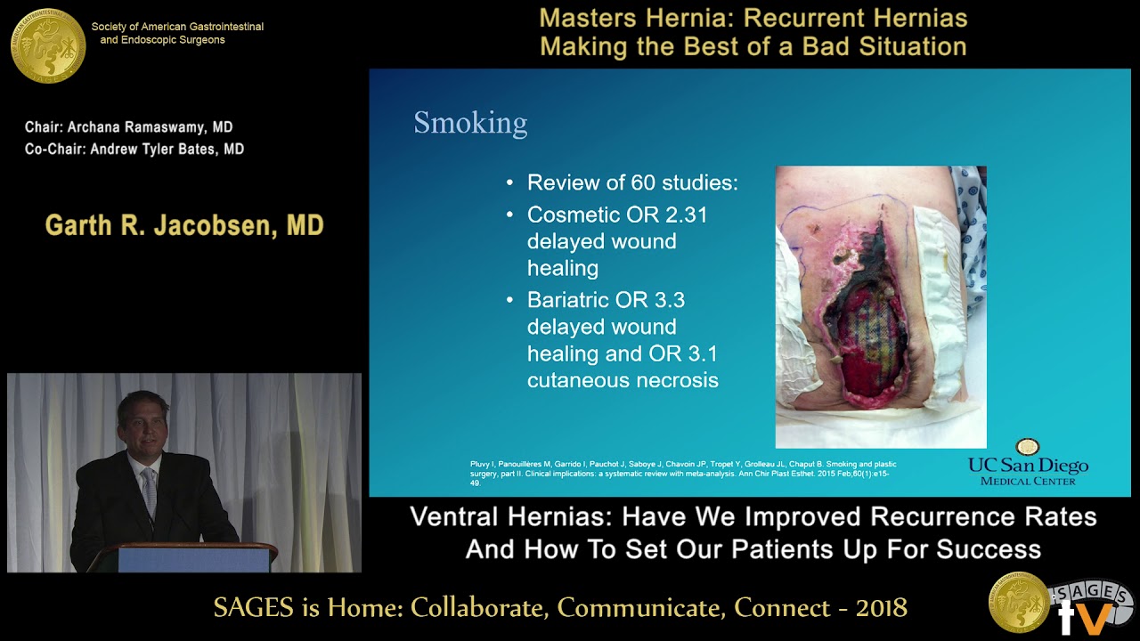 Ventral hernias: Have we improved recurrence rates & how to set our patients up for success