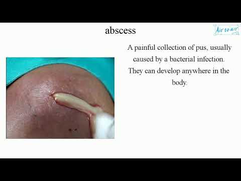 abscess (English) - Medical terminology for medical students -