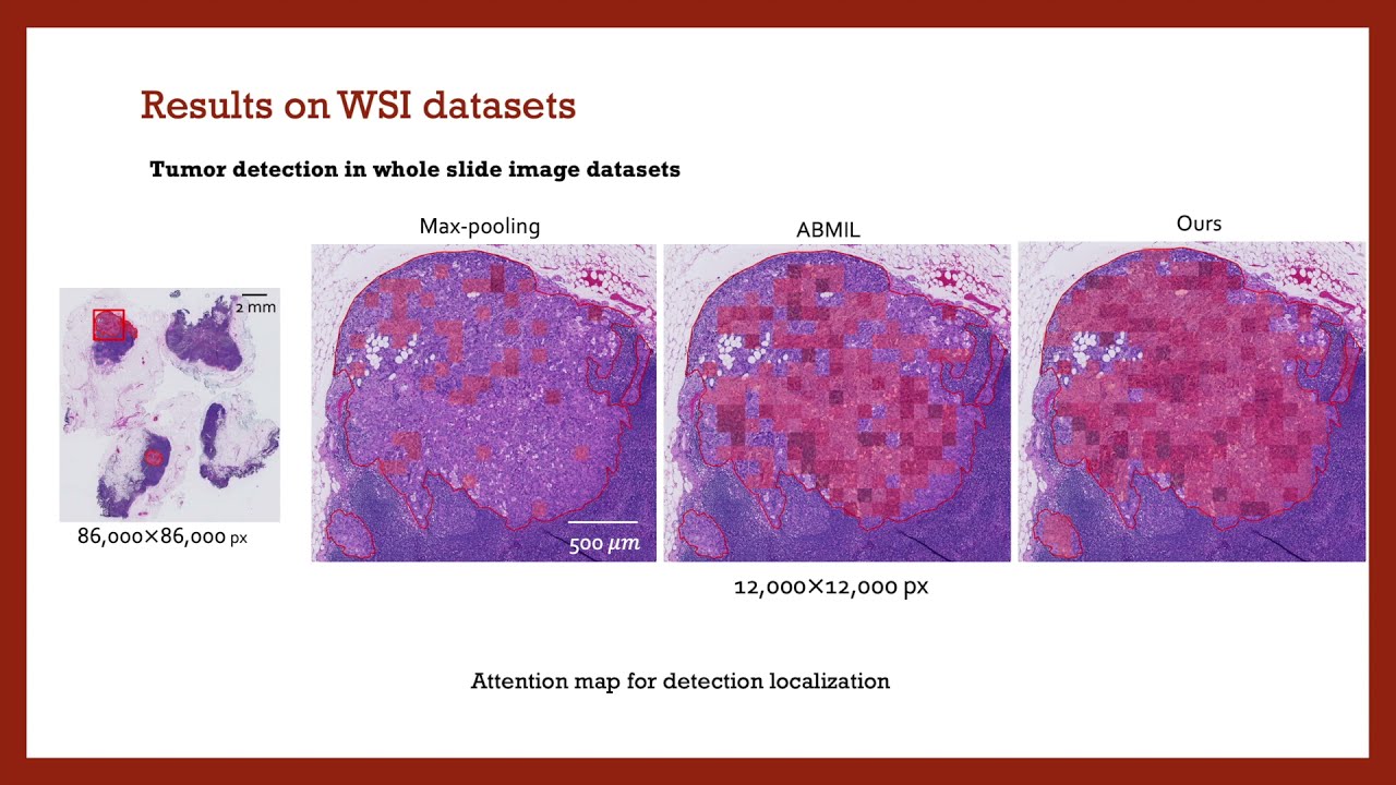 Dual-stream Multiple Instance Learning Network