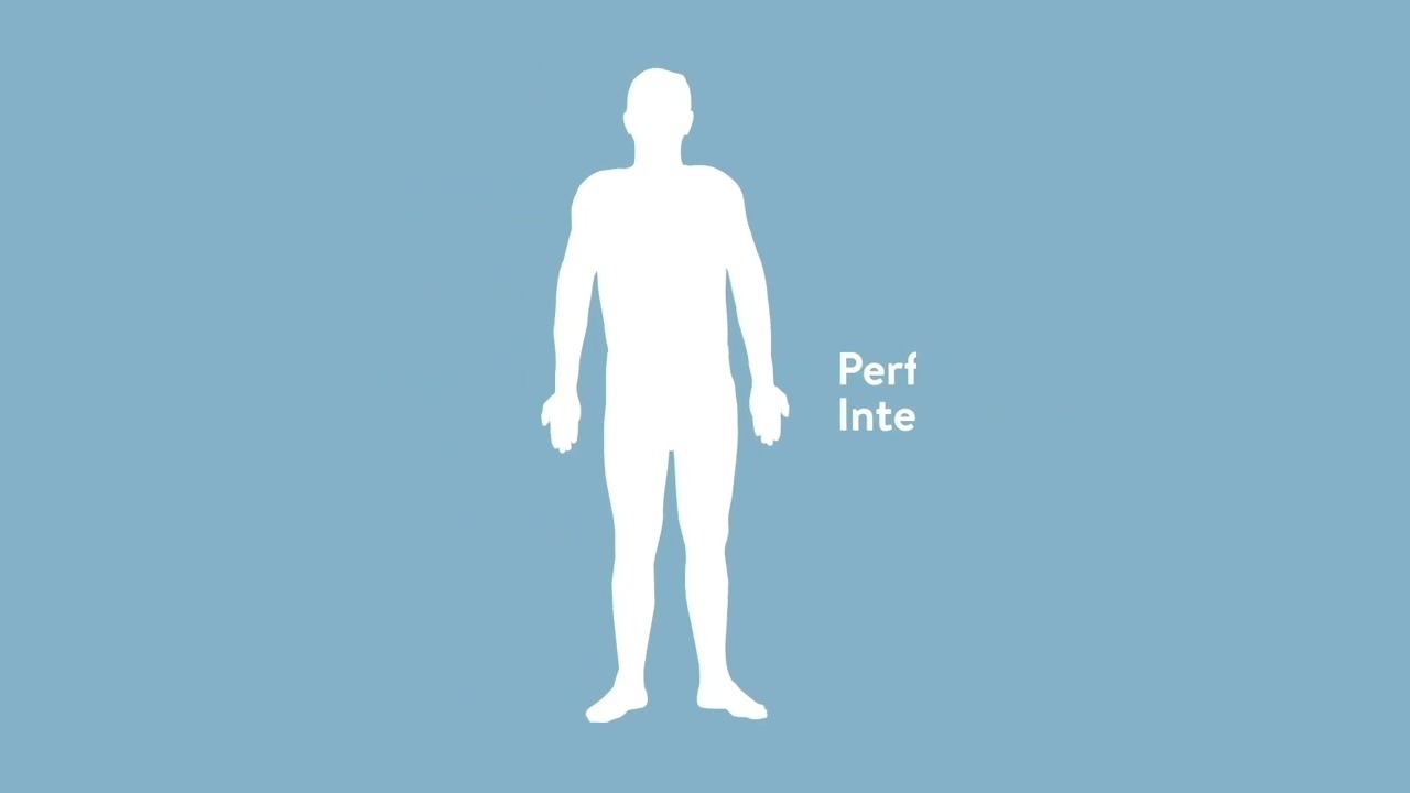 PAE Procedure Video for Patients