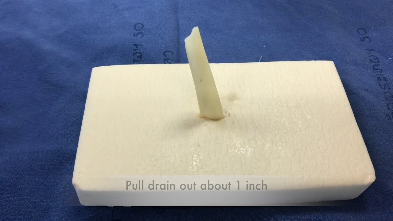 Penrose drain removal