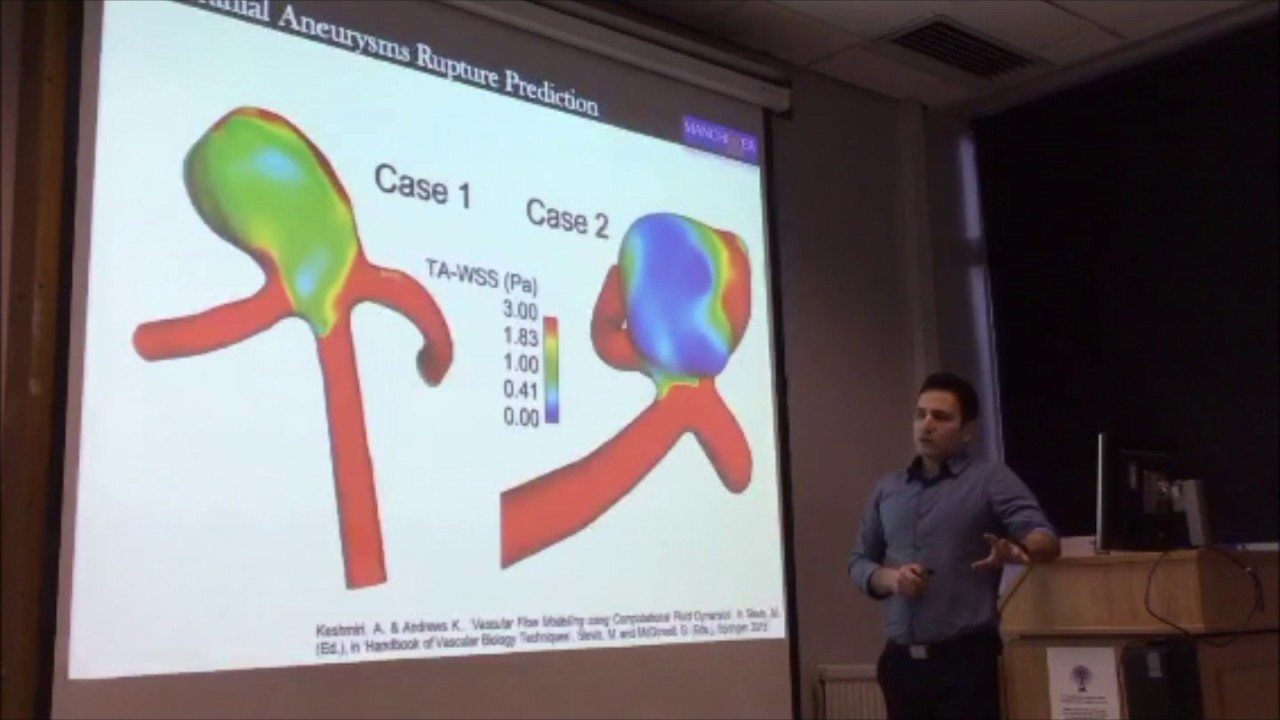 Computational Fluid Dynamics (CFD): A life-saving tool.