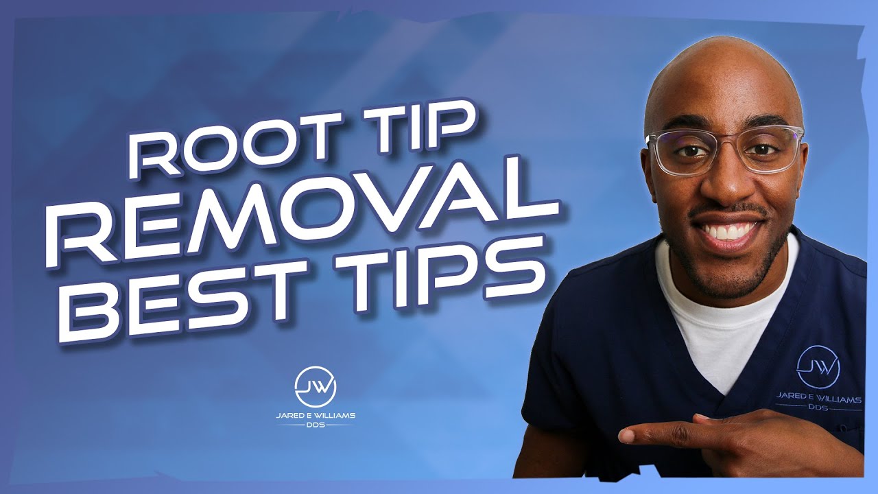 How to remove a root tip | Best Tips