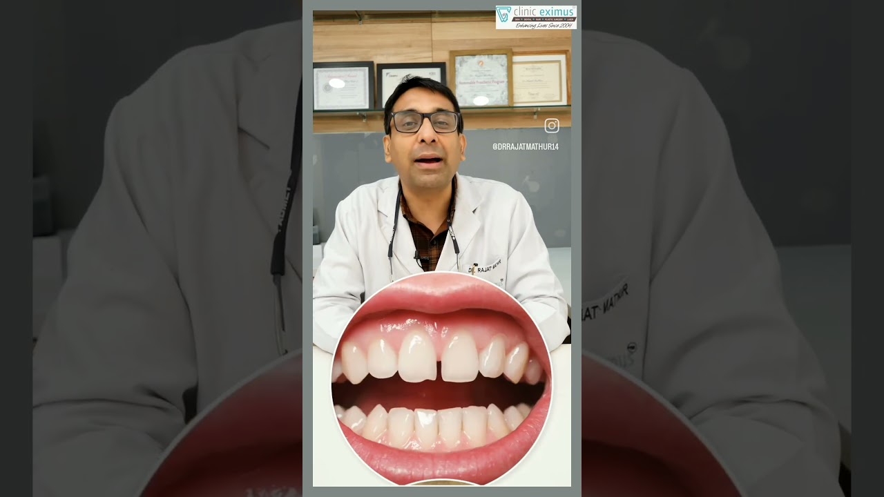 My child has gaps between her teeth what to do ?