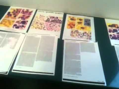 blood cells pictures explained