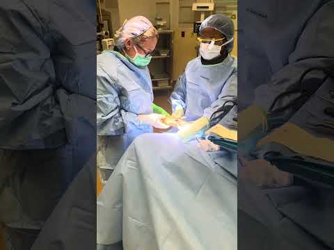 Bunion Surgery with Dr. Jodi Schoenhaus #bunions #bunion #podiatrist #florida #medical #surgeon