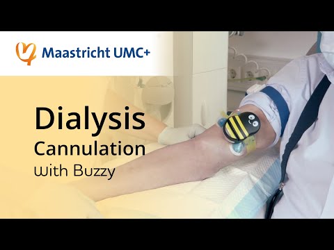 Buzzy for Cannulation Pain Relief - EDTNA/ERCA Presentation