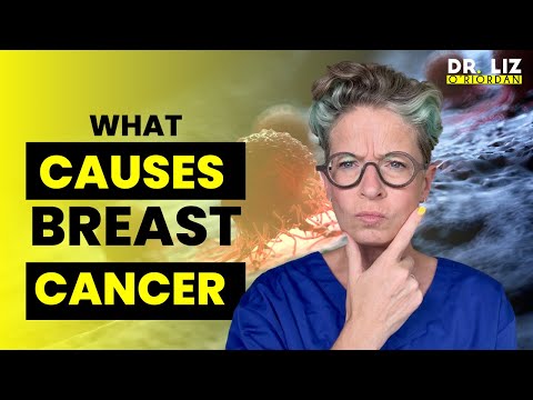 What Causes Breast Cancer in 2025: Doctor Explains All
