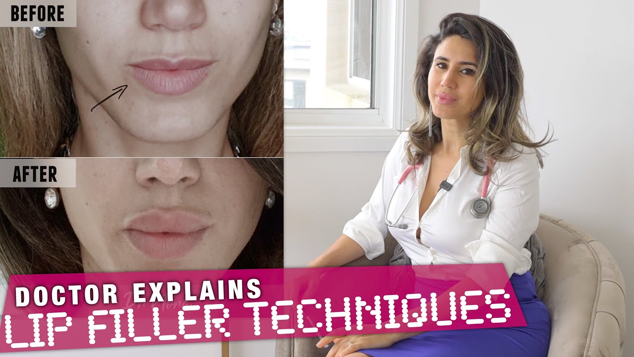 Which Lip Technique? 5 Case Studies | Doctor Explains 💋💉