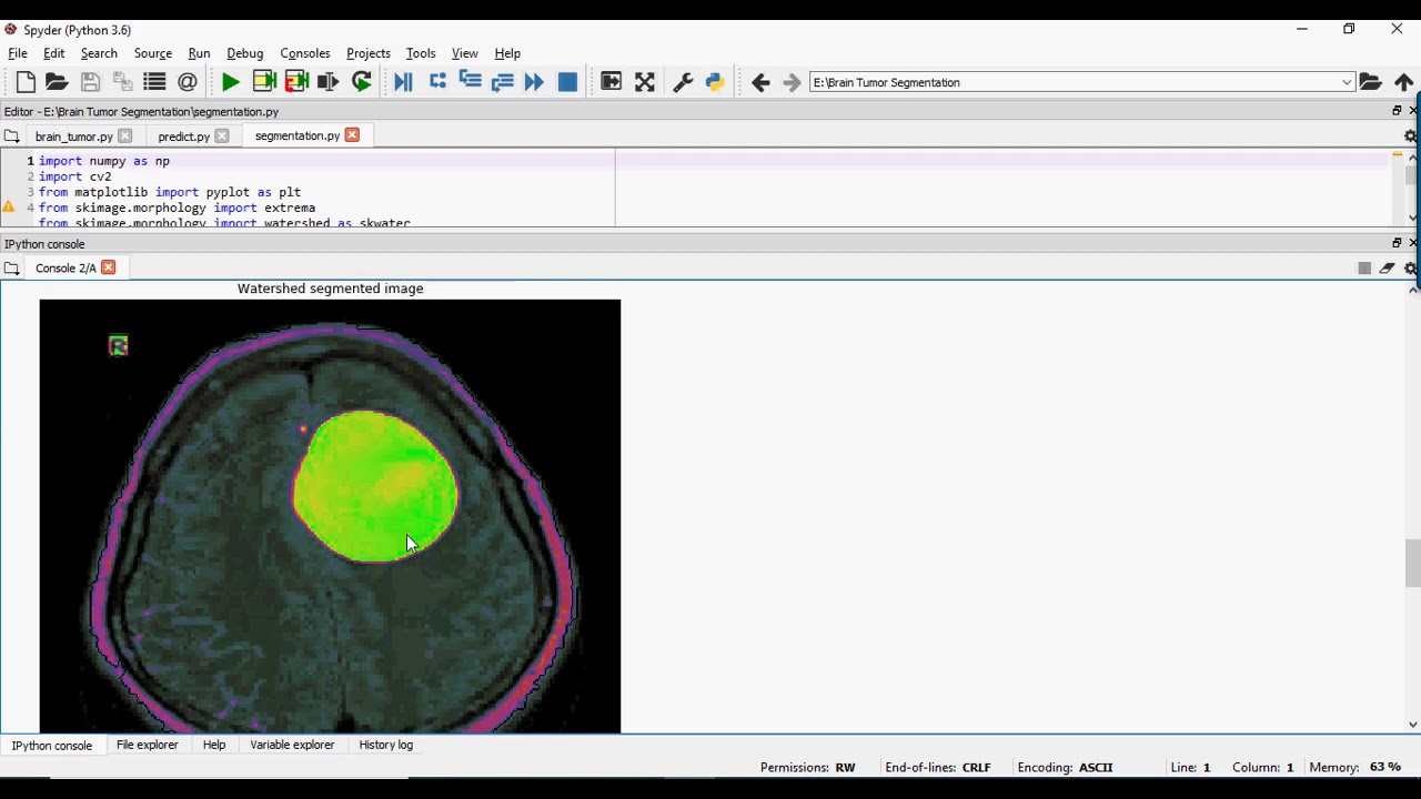 Brain Tumor Detection in Python - OKOK PROJECTS- Final Year Projects ...