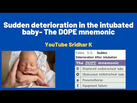 DOPE. What to do when there is sudden deterioration in ventilated baby? Dr Sridhar K