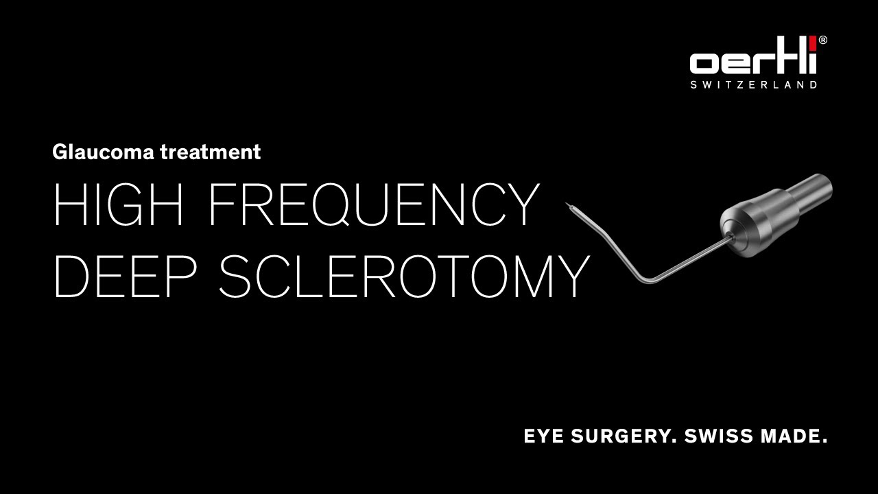 Spotlight: HFDS (High Frequency Deep Sclerotomy) | Glaucoma treatment