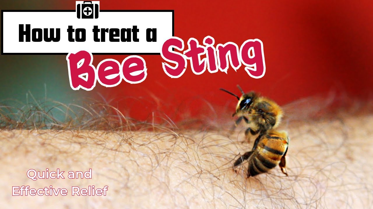 Bee Sting Pain Getting Worse? This Changes Everything