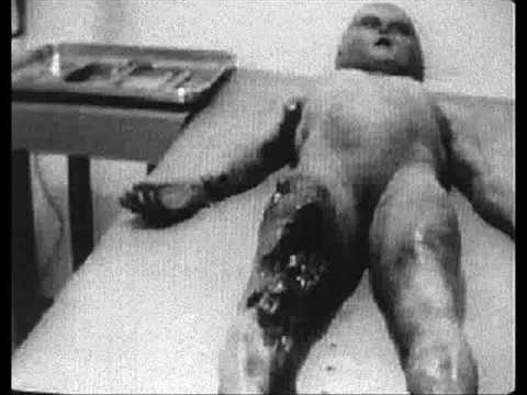 Area 51 Alien Authopsy Film-16 mm UFO doc.