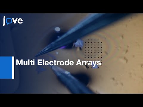 Spiral Ganglion Neuron Explant Culture & Electrophysiology-Preview